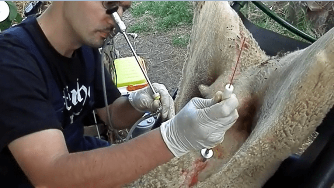 Priprema za veštačku oplodnju - Ramgen